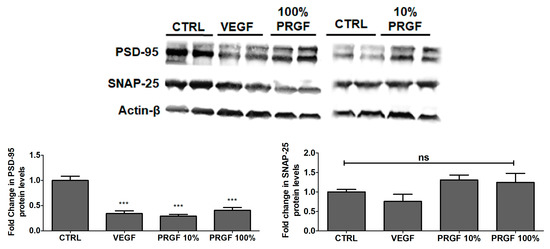 IJMS | Free Full-Text | Plasma Rich in Growth Factors (PRGF) Disrupt ...