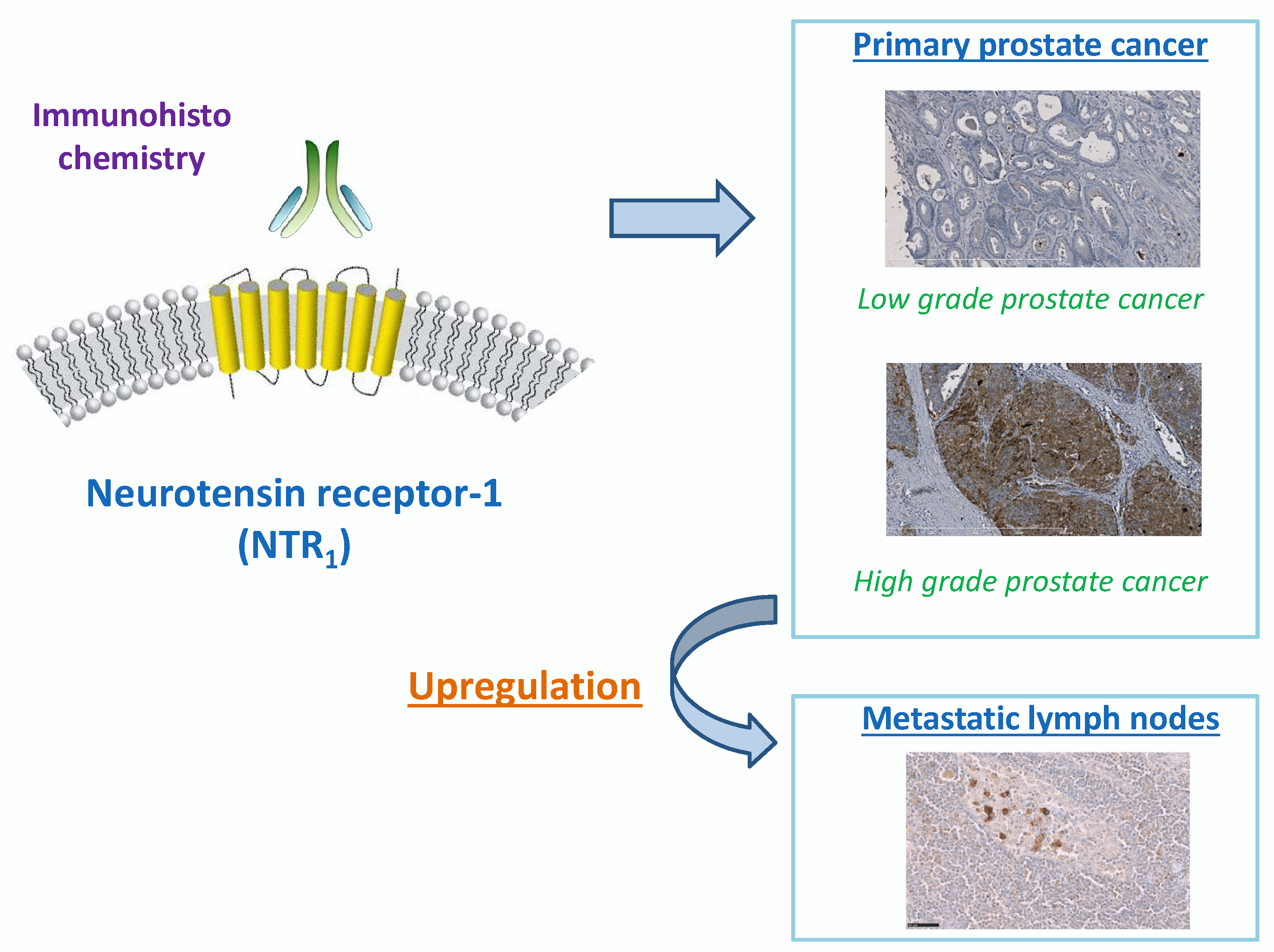 Ijms Free Full Text Neurotensin Receptor 1 Expression In Human