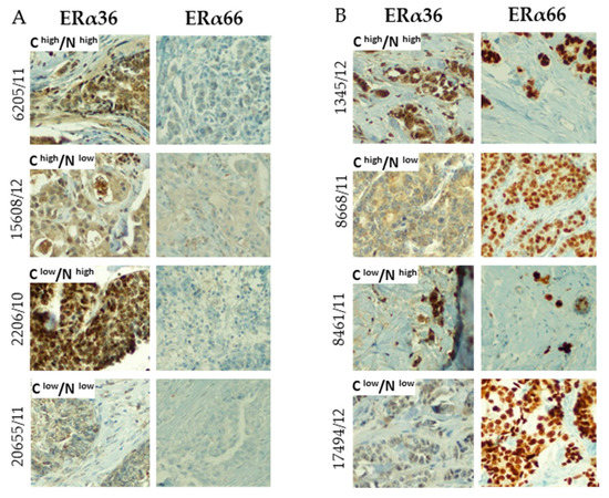IJMS | Free Full-Text | Clinical and Biological Significance of ESR1 ...