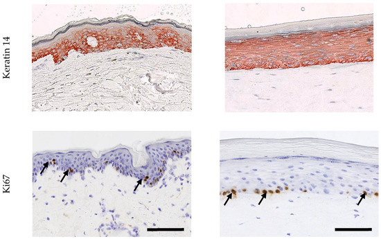 Characterization of a New Reconstructed Full Thickness Skin Model, T ...