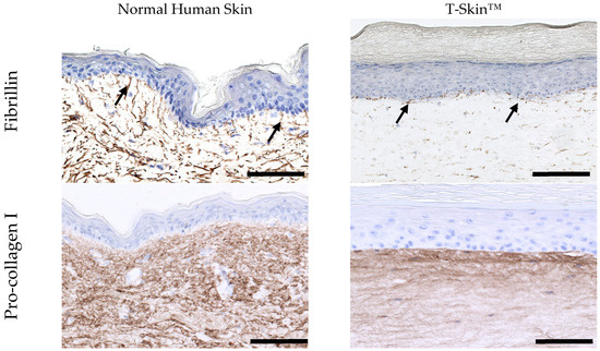 Characterization of a New Reconstructed Full Thickness Skin Model, T ...
