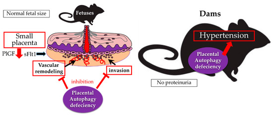 IJMS | Special Issue : Molecular and Cellular Mechanisms of Preeclampsia