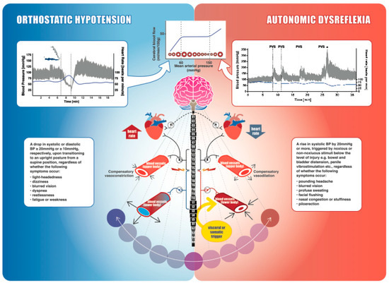 The Blood Pressure Pendulum following Spinal Cord Injury: Implications ...