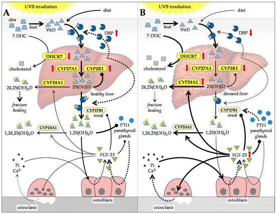 Hepatic Osteodystrophy—Molecular Mechanisms Proposed to Favor Its ...