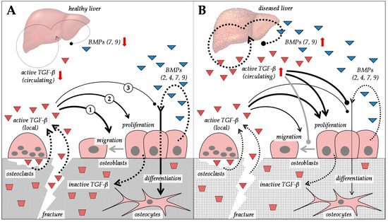 Hepatic Osteodystrophy—Molecular Mechanisms Proposed to Favor Its ...