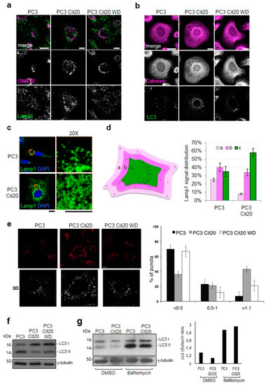 Effects of Long-Term Citrate Treatment in the PC3 Prostate Cancer Cell Line