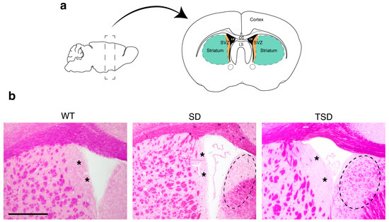 IJMS | Free Full-Text | Integrated Computational Analysis Highlights ...