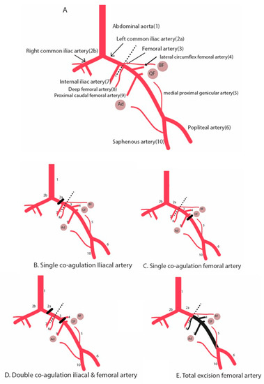 IJMS | Special Issue : Arteriogenesis—Molecular Regulation ...