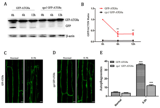 Correlation of Autophagosome Formation with Degradation and Endocytosis ...