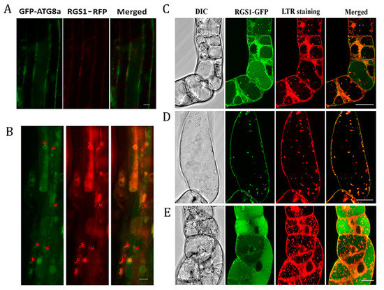 Correlation of Autophagosome Formation with Degradation and Endocytosis ...