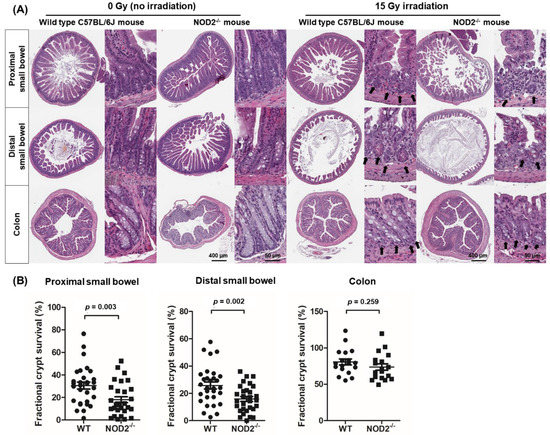 NOD2 Supports Crypt Survival and Epithelial Regeneration after ...