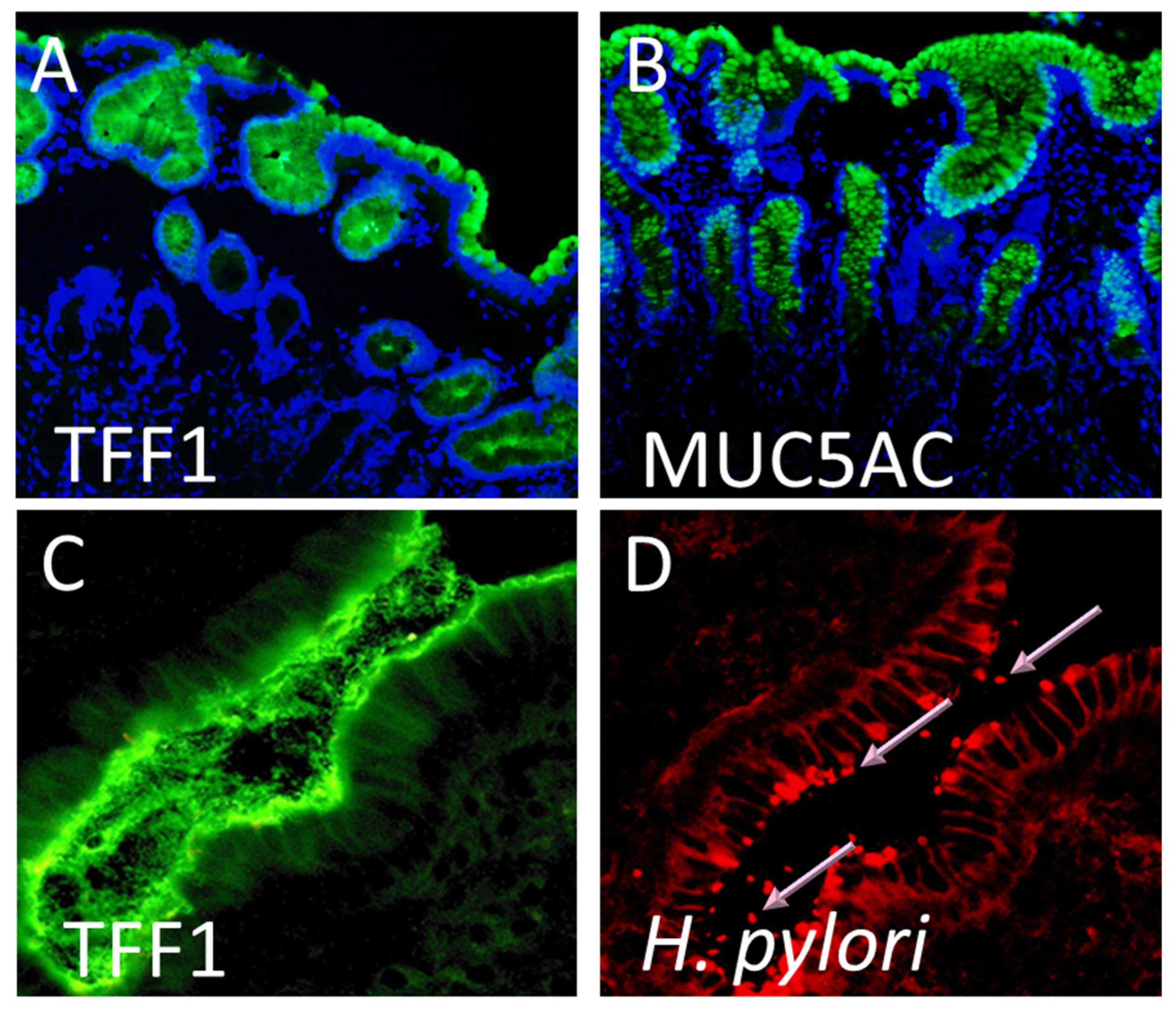 Ijms Free Full Text The Interaction Of Helicobacter Pylori With