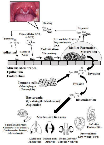The Pathogenic Factors from Oral Streptococci for Systemic Diseases