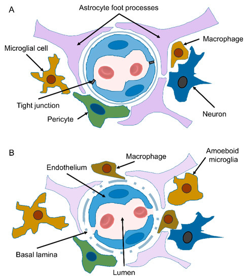 IJMS | Special Issue : Cerebral Amyloid Angiopathy: Causes, Diagnosis ...