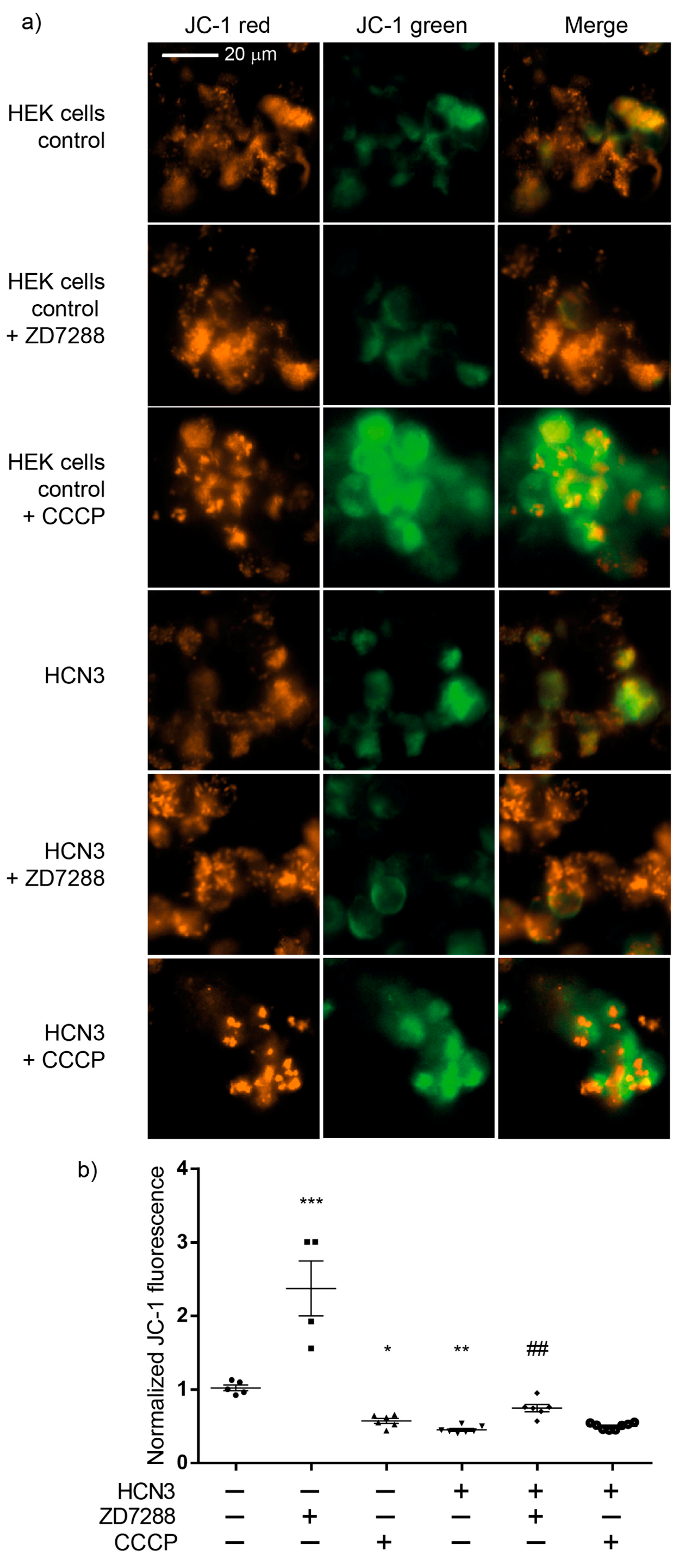 Novel Potassium Channels in Kidney Mitochondria: The Hyperpolarization ...