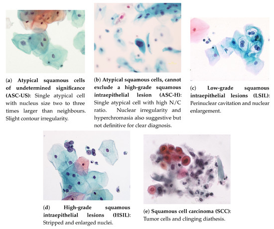 Ijms Free Full Text A Review Of Computational Methods For Cervical