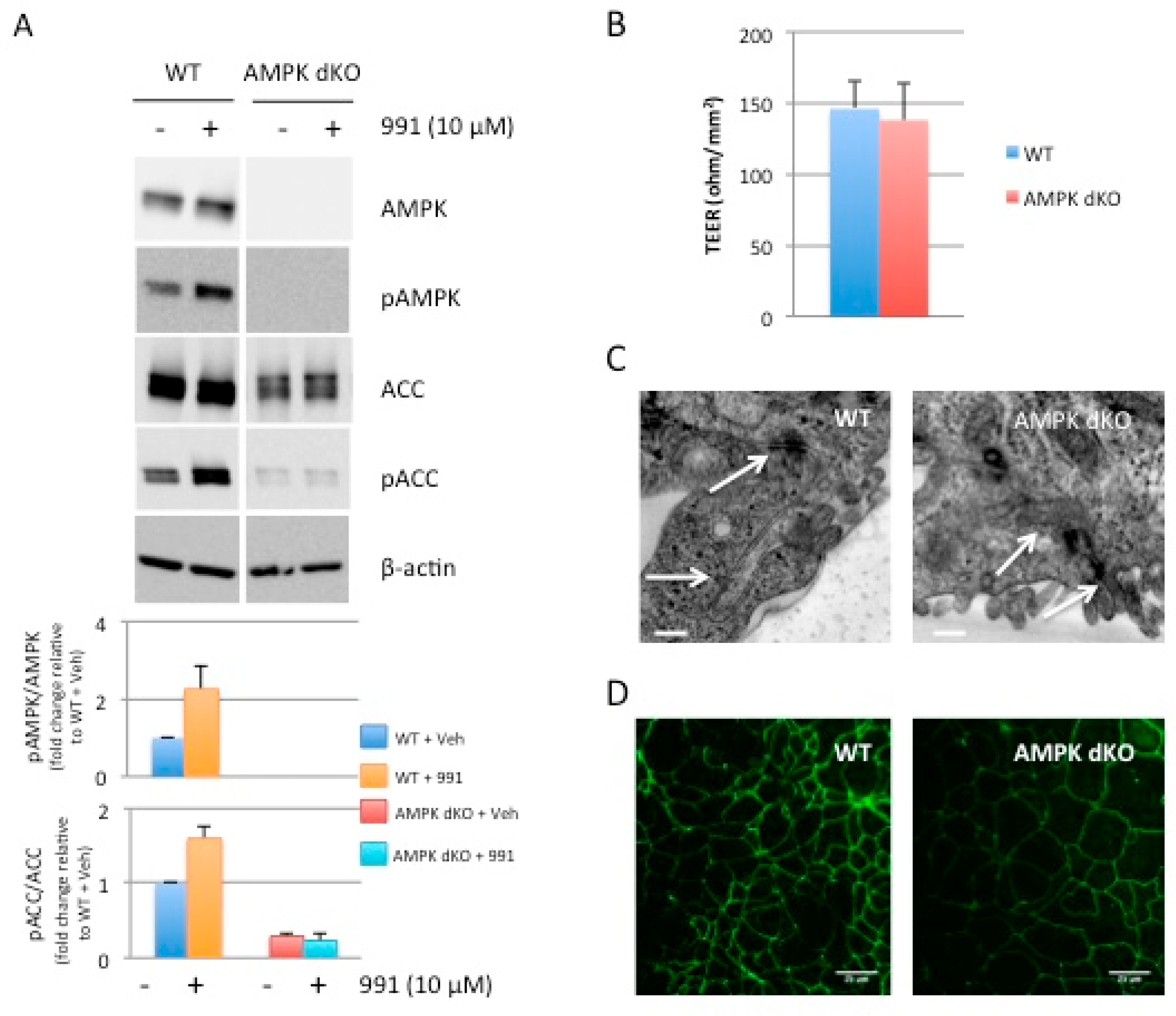 AMPK Activation Promotes Tight Junction Assembly in Intestinal ...