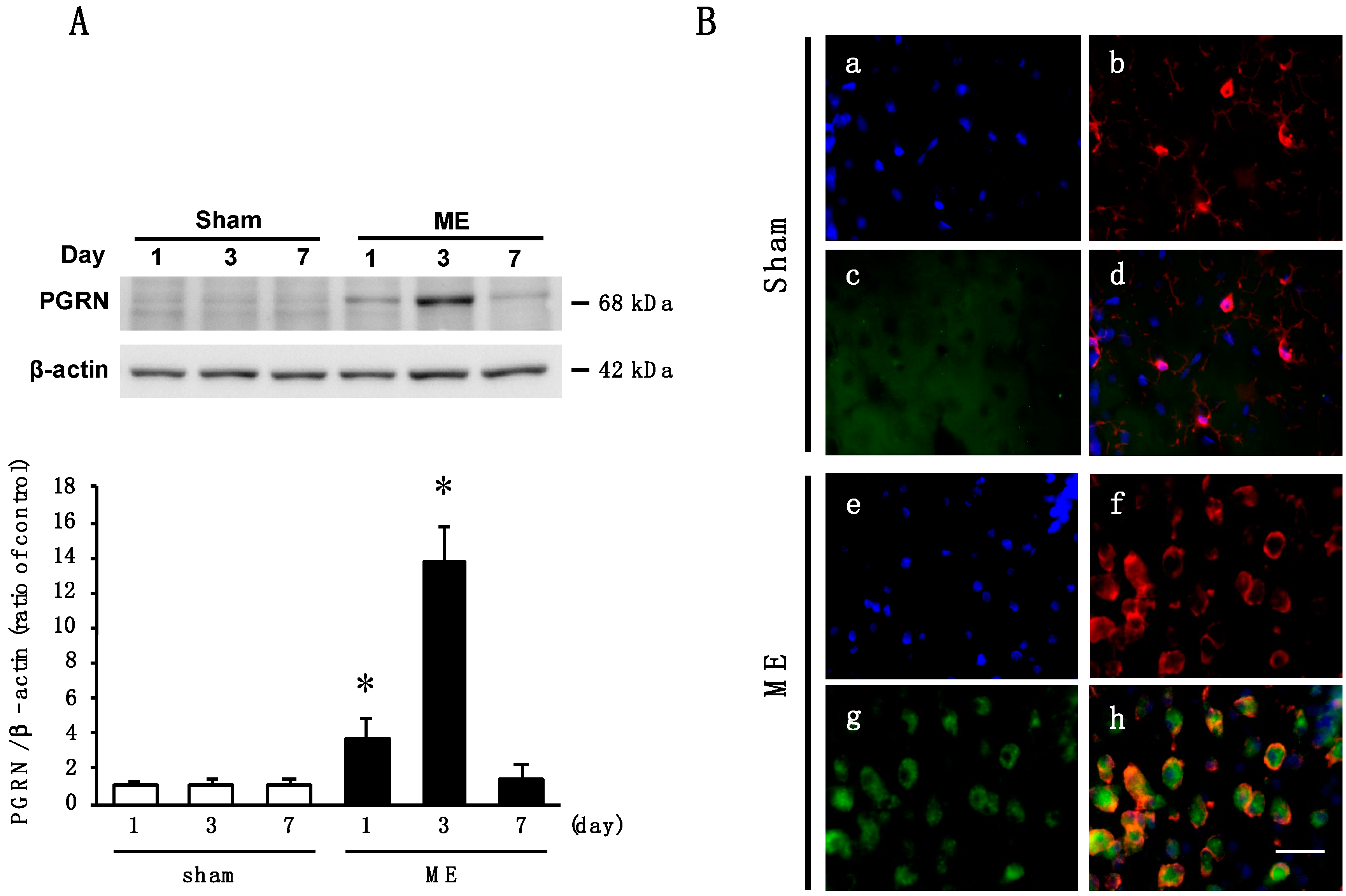 IJMS | Free Full-Text | Involvement of Progranulin and Granulin ...