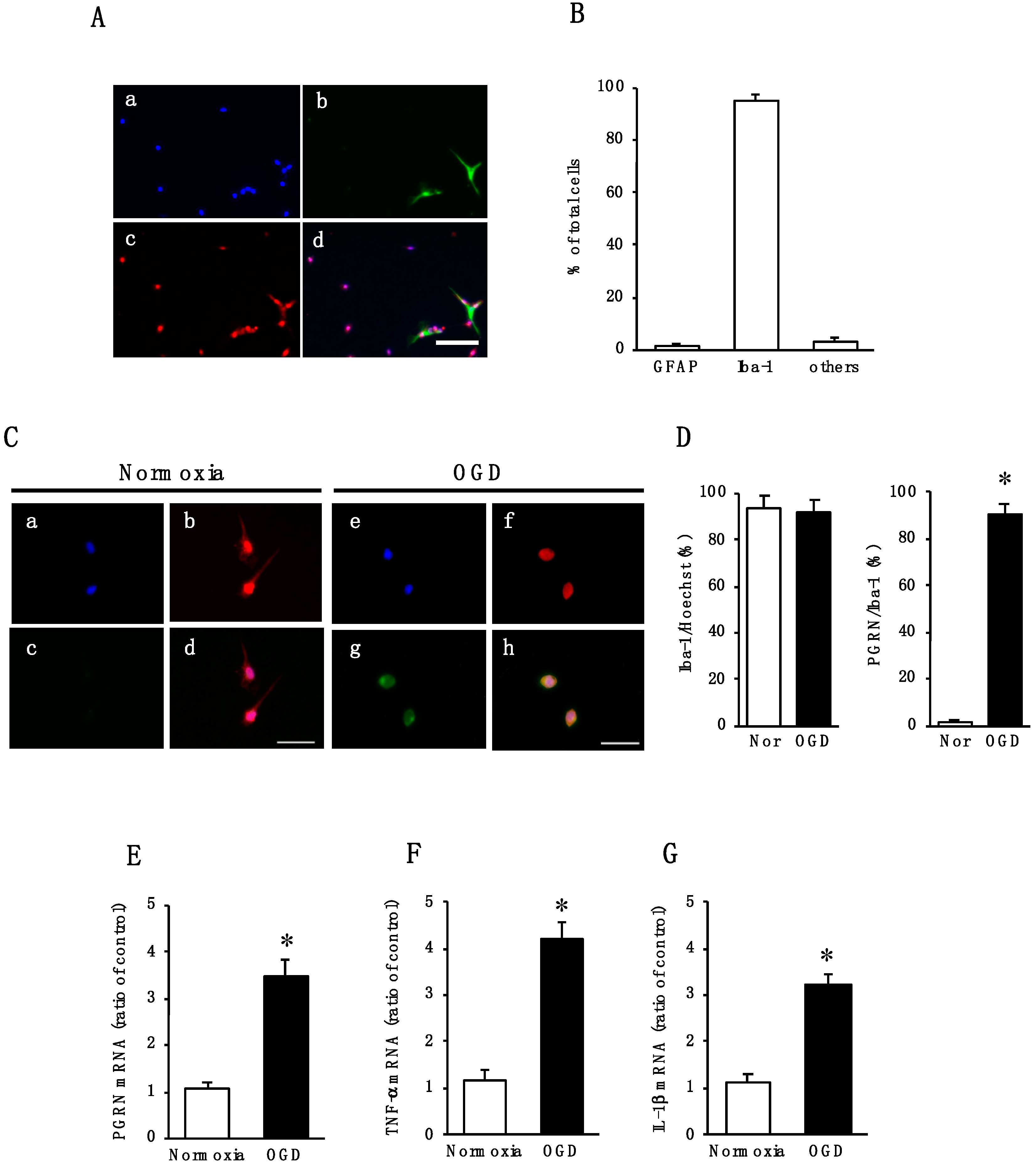 IJMS | Free Full-Text | Involvement of Progranulin and Granulin ...