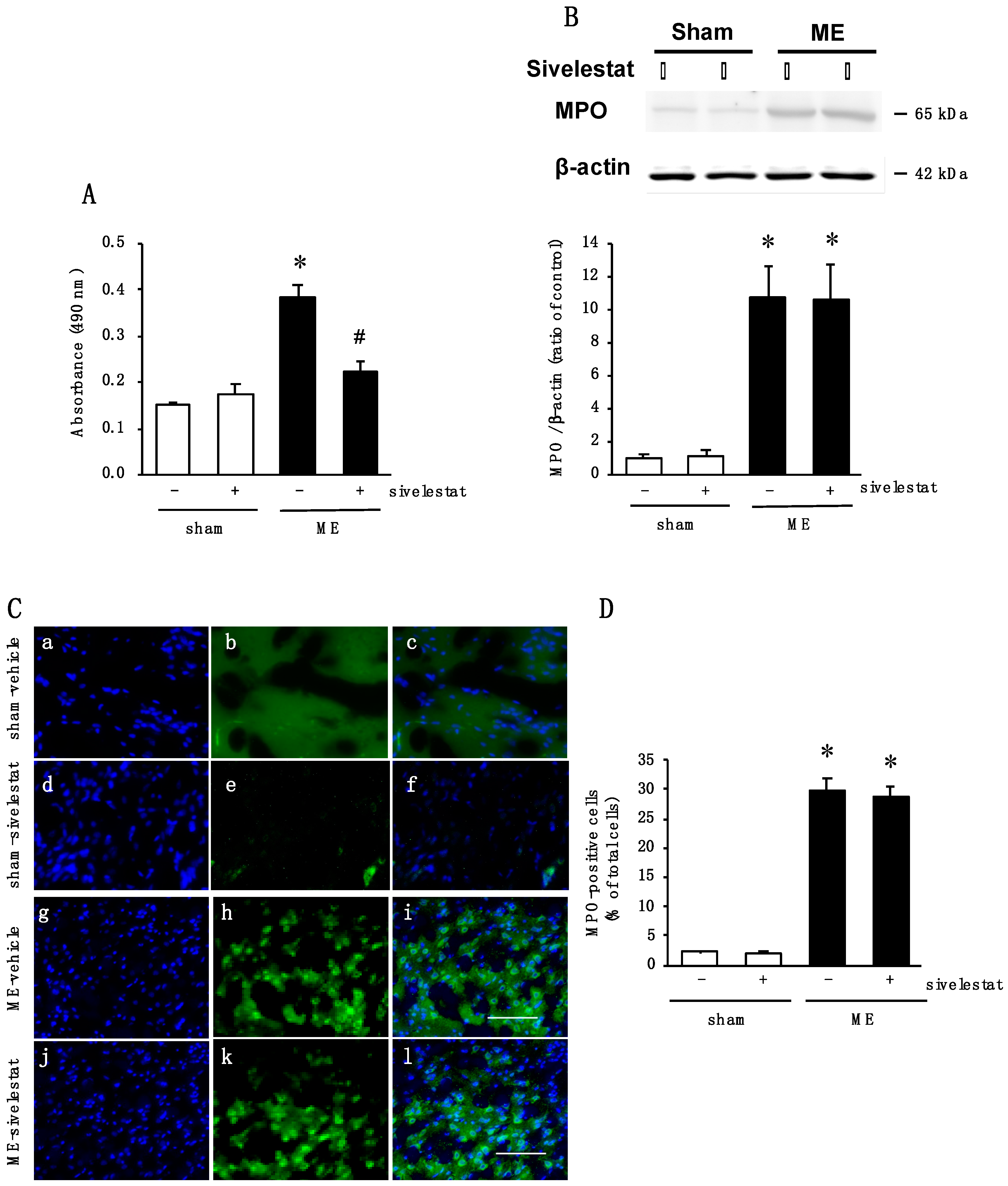 IJMS | Free Full-Text | Involvement of Progranulin and Granulin ...