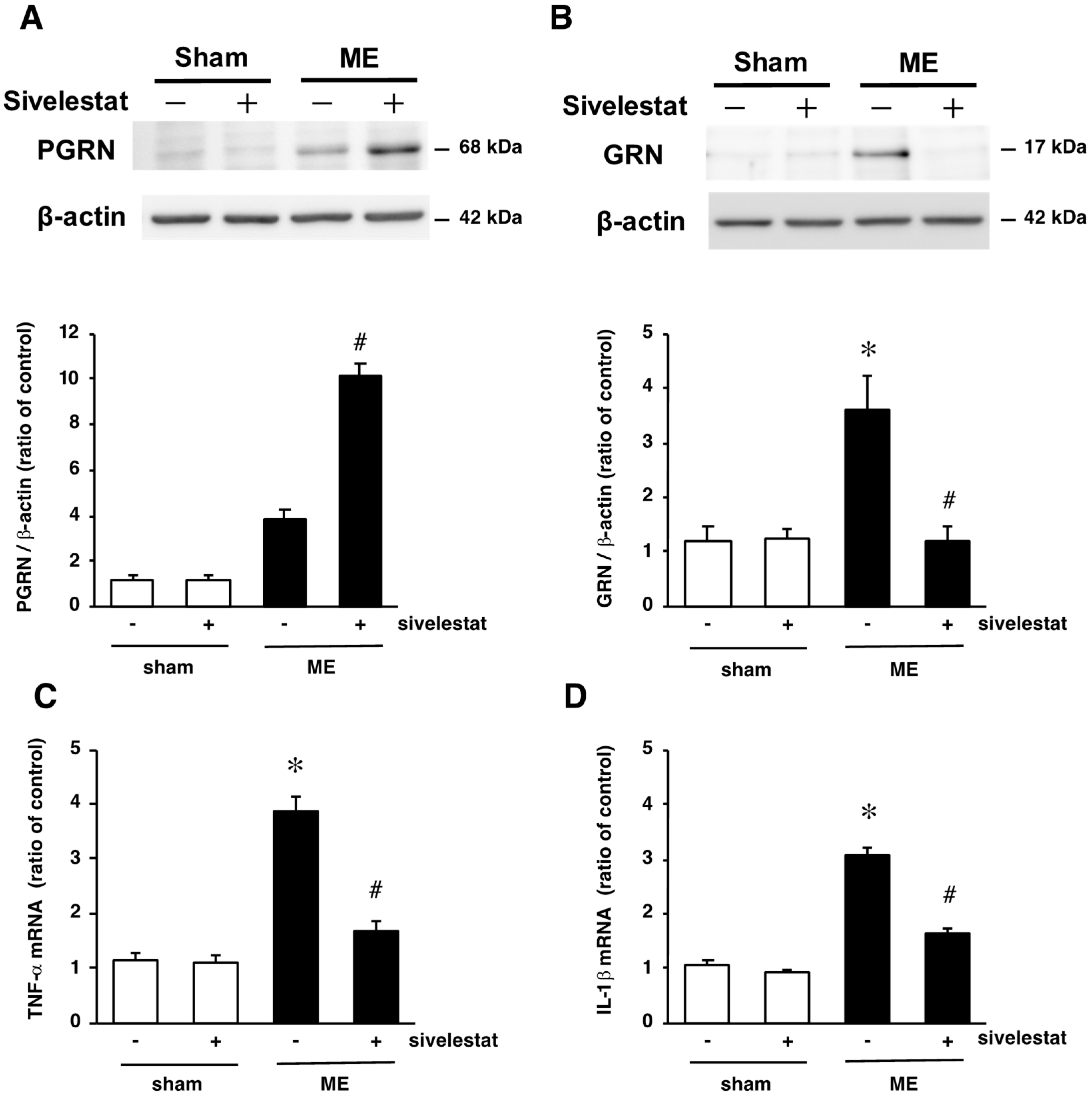 IJMS | Free Full-Text | Involvement of Progranulin and Granulin ...