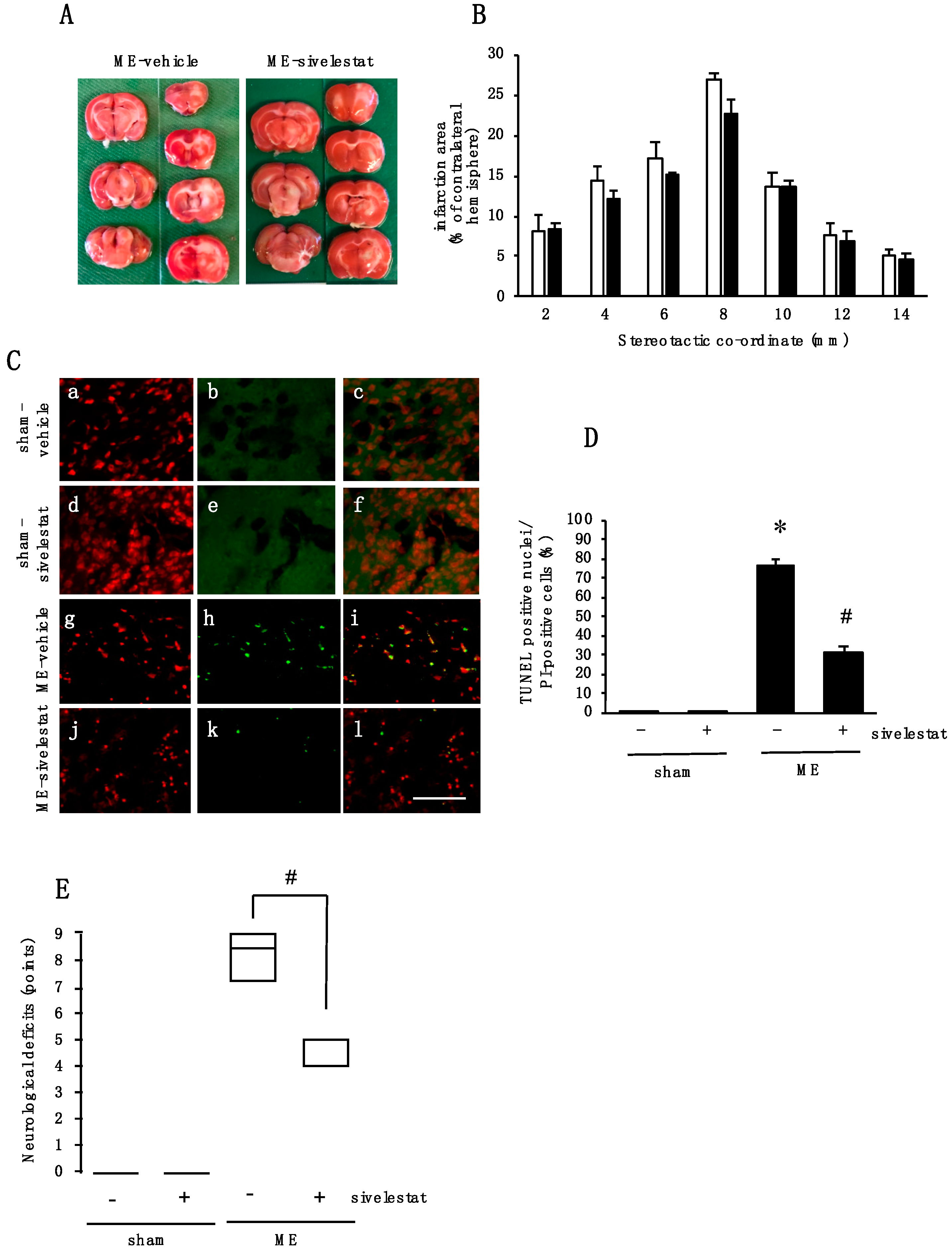 IJMS | Free Full-Text | Involvement of Progranulin and Granulin ...