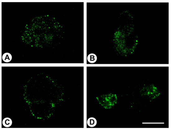 Comprehensive Assessment of GPR68 Expression in Normal and Neoplastic ...