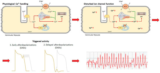 Pathophysiology of Calcium Mediated Ventricular Arrhythmias and Novel ...