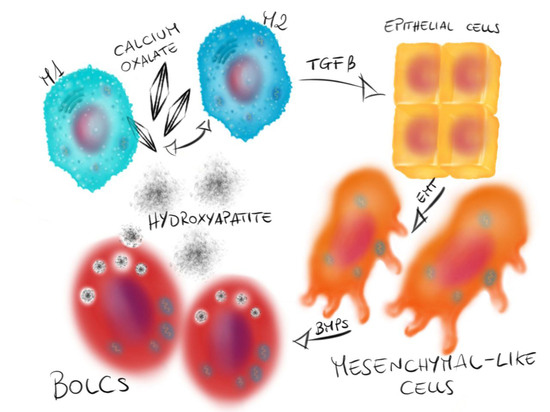 IJMS | Free Full-Text | Microcalcifications Drive Breast Cancer ...