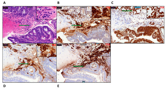 Development and Characterization of a Genetic Mouse Model of KRAS ...