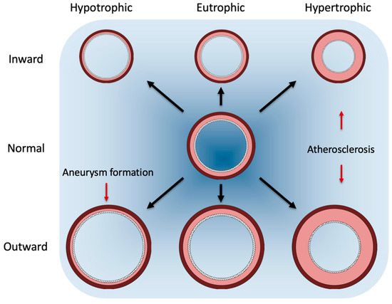 The Role of Vascular Smooth Muscle Cells in Arterial Remodeling: Focus ...