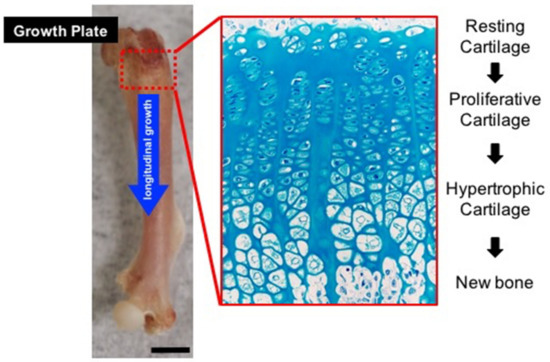 Recent Insights into Long Bone Development: Central Role of Hedgehog ...