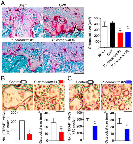 IJMS | Free Full-Text | Pisidium coreanum Inhibits Multinucleated ...