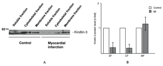 The Integrin Activating Protein Kindlin-3 Is Cleaved in Human Platelets ...
