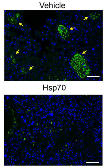 Extracellular Hsp70 Reduces the Pro-Tumor Capacity of Monocytes ...