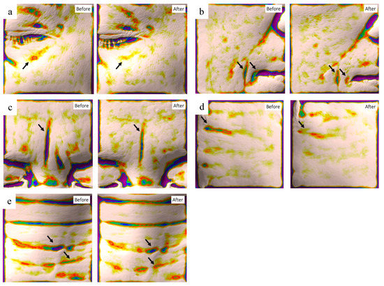 Anti-Wrinkle Benefits of Peptides Complex Stimulating Skin Basement ...