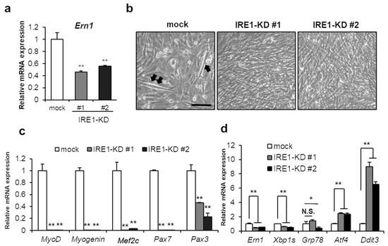 IJMS | Free Full-Text | IRE1-XBP1 Pathway of the Unfolded Protein ...