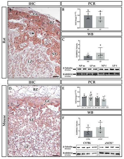 Expression of Retinoid Acid Receptor-Responsive Genes in Rodent Models ...
