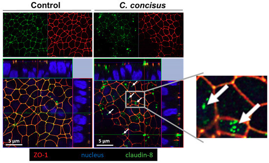 Campylobacter concisus Impairs Sodium Absorption in Colonic Epithelium ...