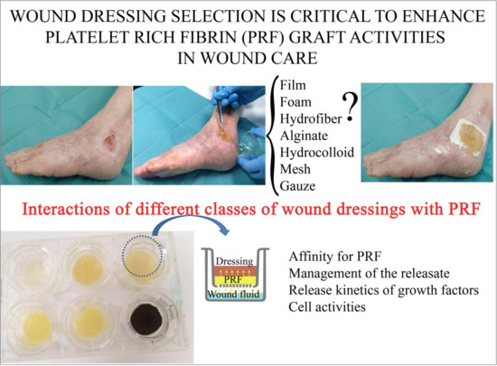 IJMS | Free Full-Text | Wound Dressing Selection Is Critical to Enhance ...