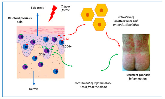 IJMS | Special Issue : Therapy and Prevention of Atopic Dermatitis and Psoriasis
