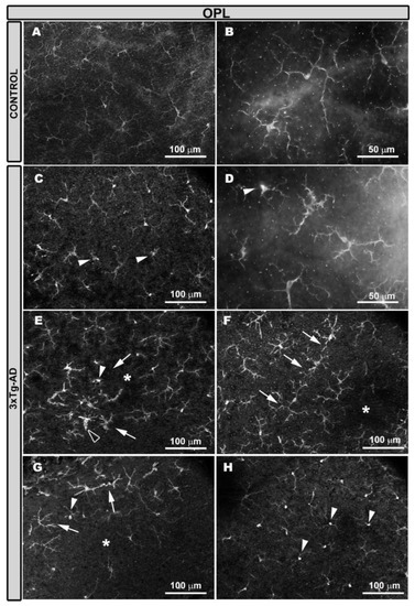 Microglial Activation in the Retina of a Triple-Transgenic Alzheimer’s ...