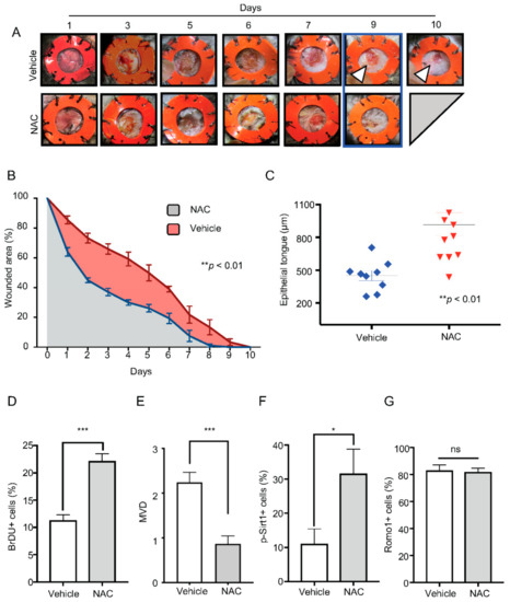 BMAL1 Modulates Epidermal Healing in a Process Involving the ...