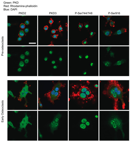 Regulation of Osteoclast Differentiation at Multiple Stages by Protein ...