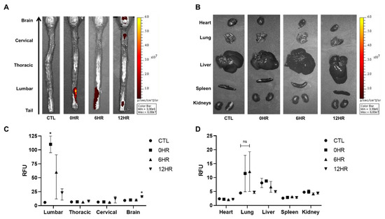 Intrathecal Injection in a Rat Model: A Potential Route to Deliver ...