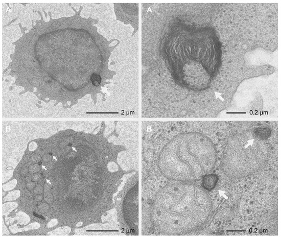 Ijms Special Issue Inherited Retinal Diseases How Can We Move