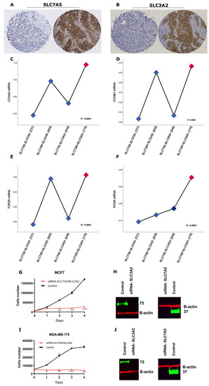 IJMS | Free Full-Text | Co-Expression Effect of SLC7A5/SLC3A2 to ...