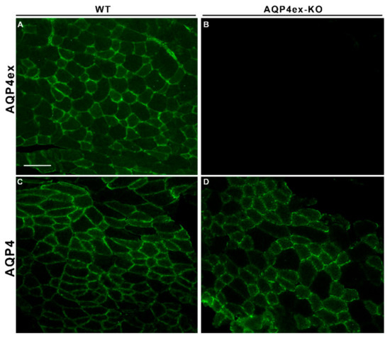 Tissue Distribution of the Readthrough Isoform of AQP4 Reveals a Dual ...