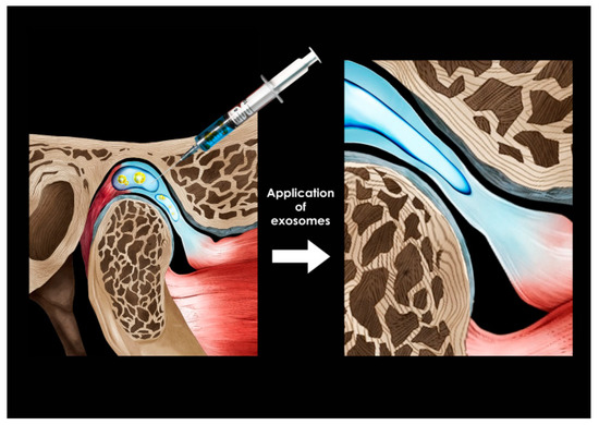 Emerging Potential of Exosomes in Regenerative Medicine for ...