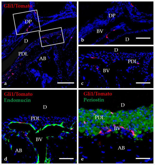 Sonic Hedgehog Signaling and Tooth Development